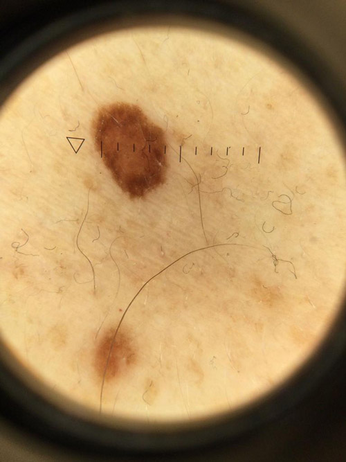 Prendiamoci cura della nostra pelle: visita dermatologica ed ...